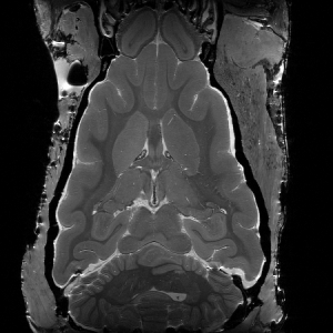 Ferret Brain Anatomical MRI (ex vivo) - Biomedical Research Imaging Center