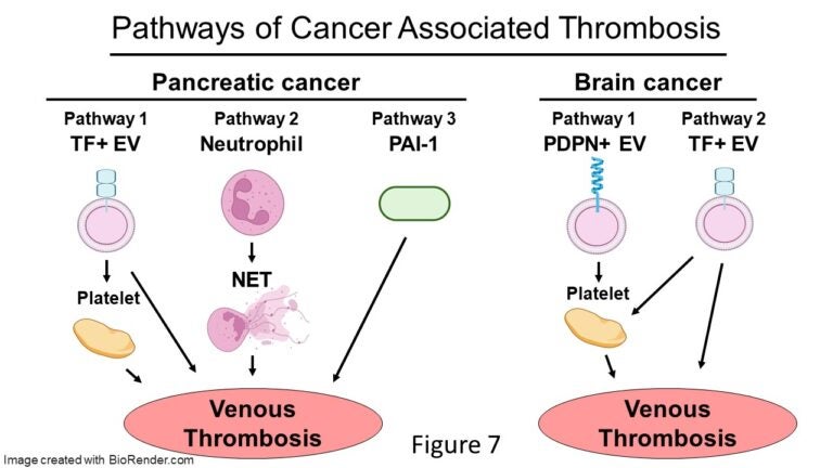 Cancer-associated Thrombosis | Mackman Lab