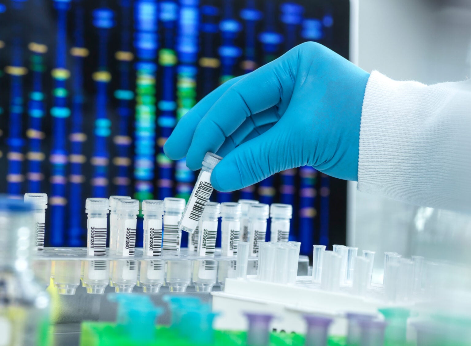 Understanding X-ALD and Its Impact on Women | Department of Neurology