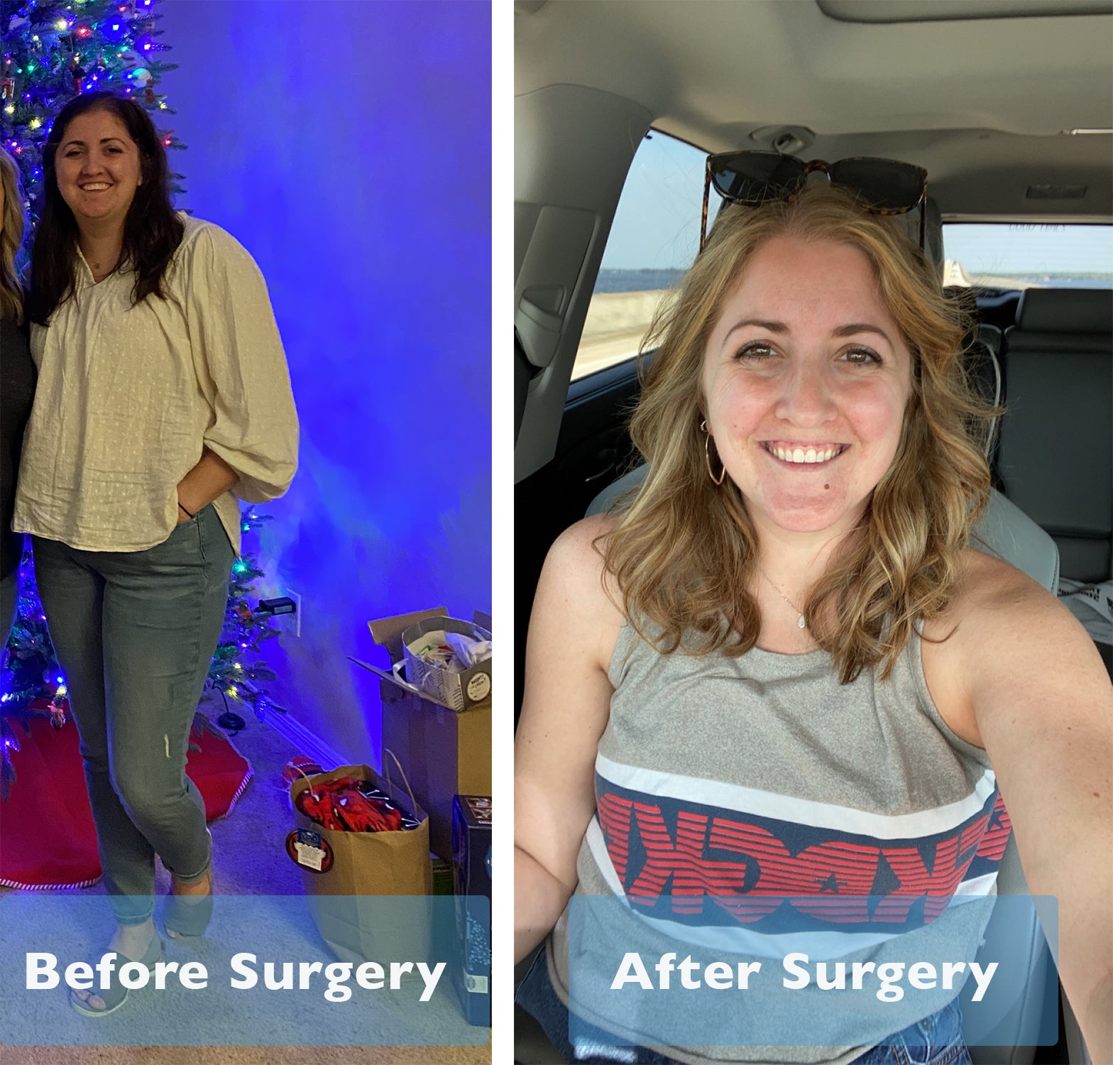 “I don’t Feel Normal” – The Diagnosis of a Pituitary Tumor & Cushing’s ...