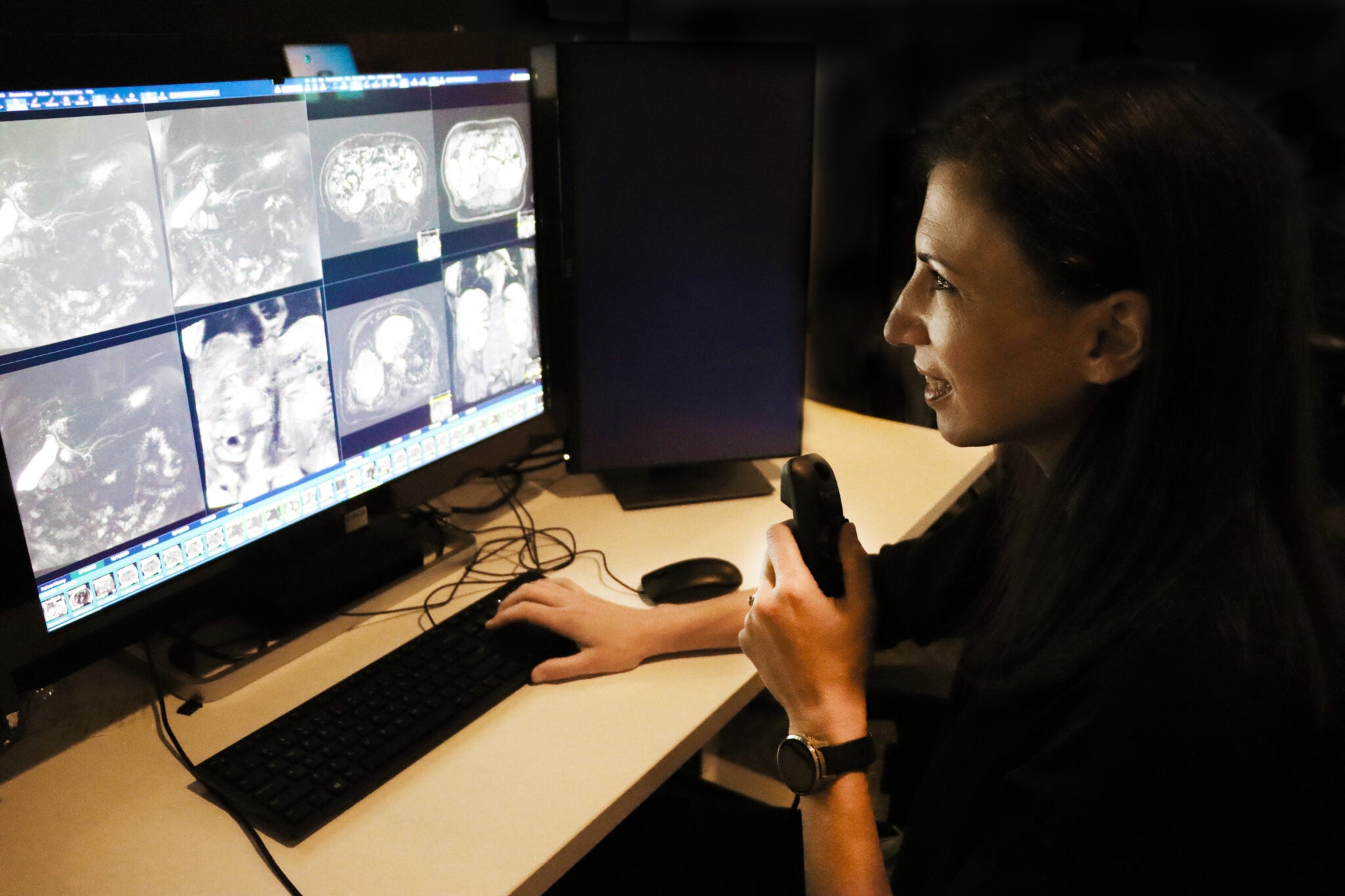 For Patients | UNC Department of Radiology